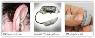 SoundBite™ Hearing System Gets European CE Mark–Wireless Hearing Aid ...